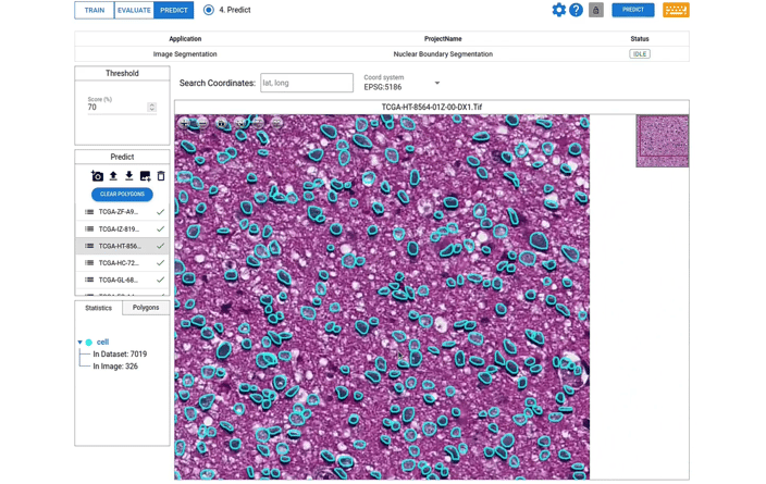 Automated Segmentation of Mitochondria with Deep Block