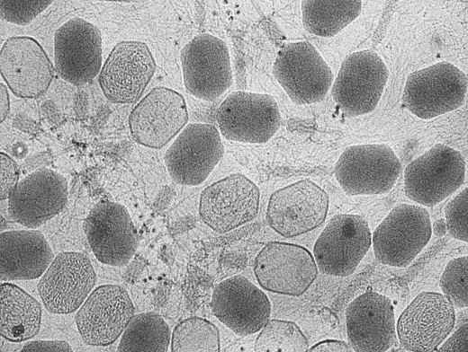 Exploring the Microscopic World: A Guide to Different Microscope Types
